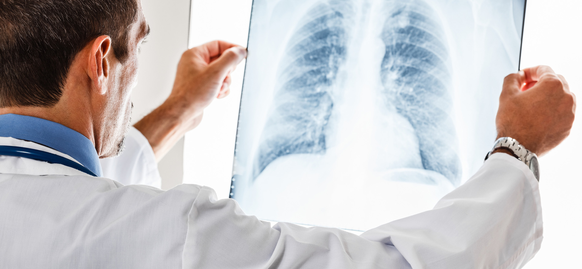 Longkanker, symptomen en onderzoeken | Pfizer