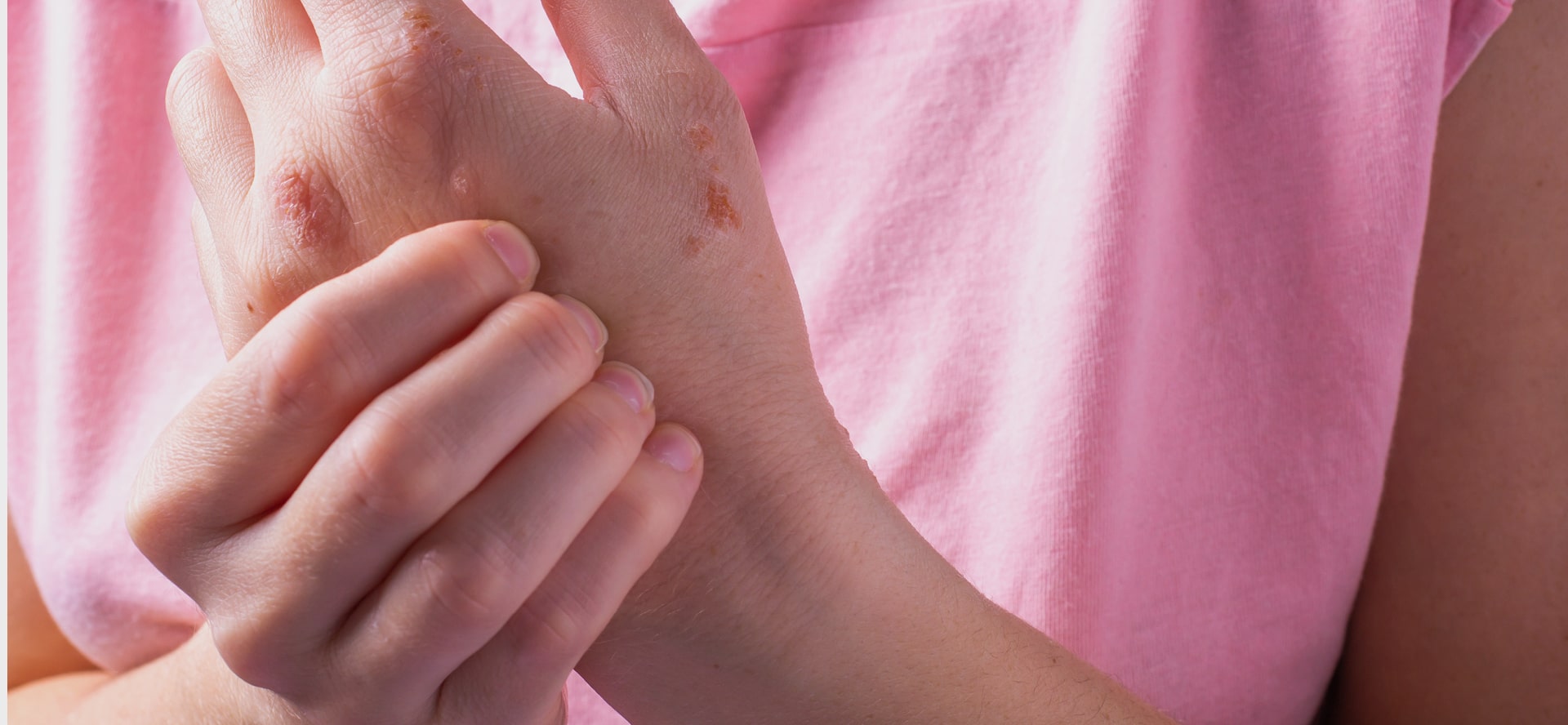 Methotrexaat | Pfizer