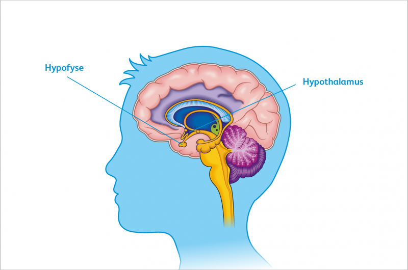 Groeihormoontekort bij volwassenen | Pfizer